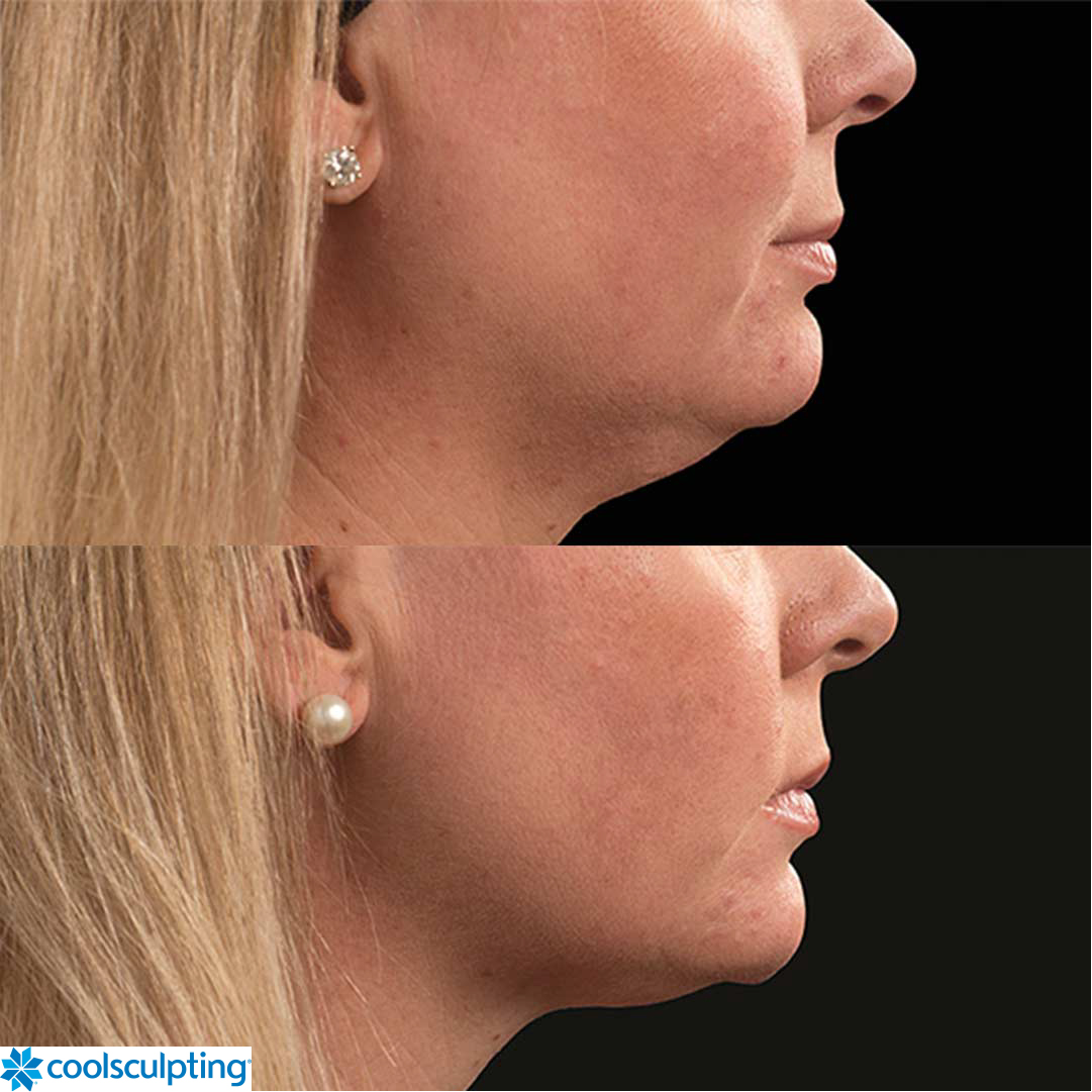 Plastic Surgeon Tariq Ahmad - Cambridge Clear Beauty